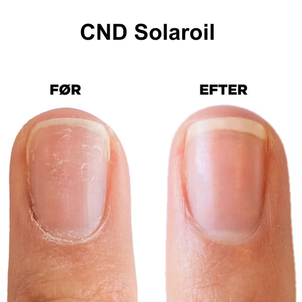 CND Solaroil Nail & Cuticle Treatment i en smart PEN